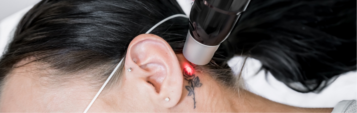 XTRAC Laser Therapy in Boca Raton | Psoriasis Treatment